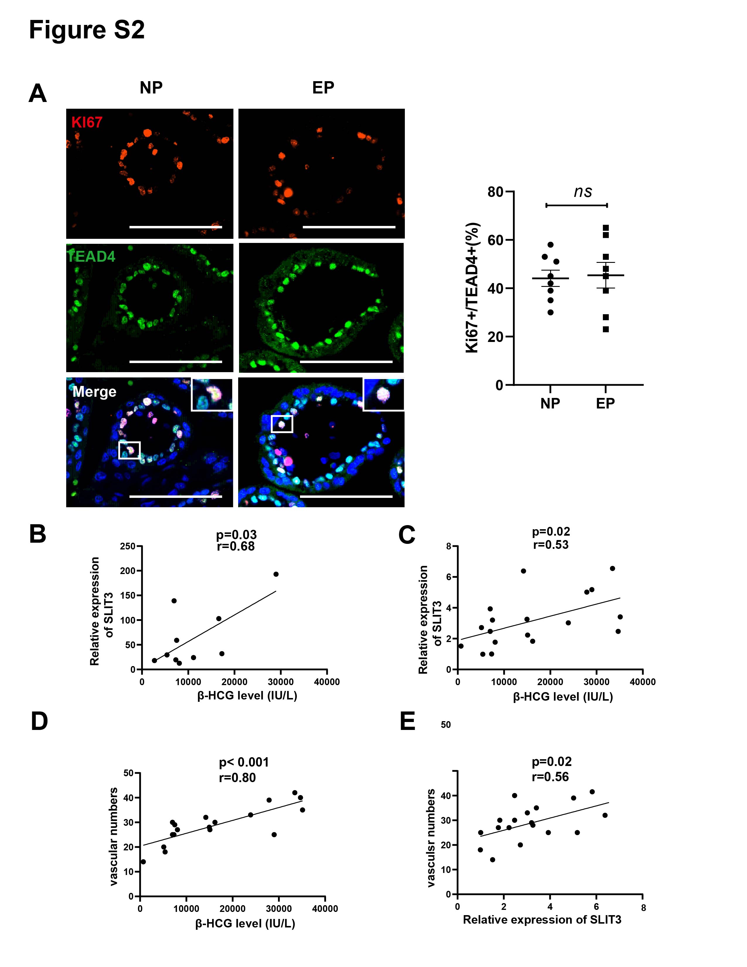Abnormal expression of SLIT3 induces intravillous vascularization ...