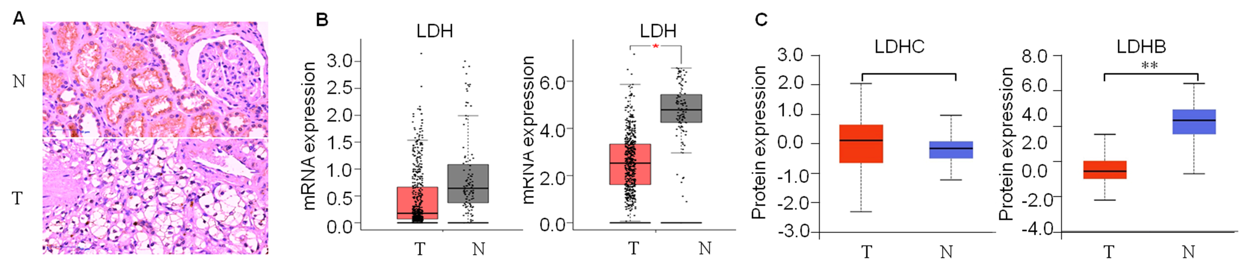 The novel role of LDHA/LDHB in the prognostic value and tumor-immune ...