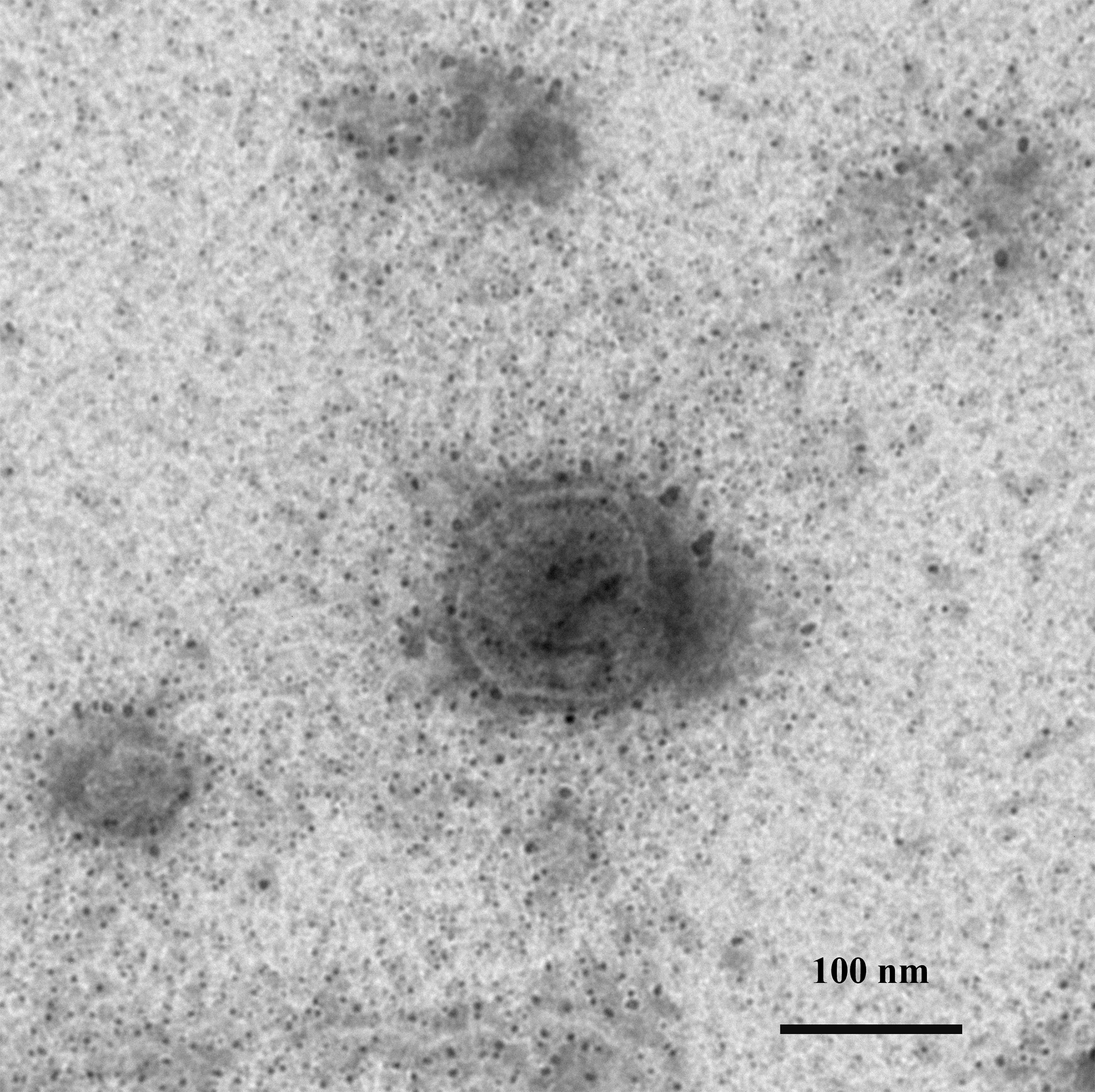 Tilapia lake virus causes mitochondrial damage: a proposed mechanism ...