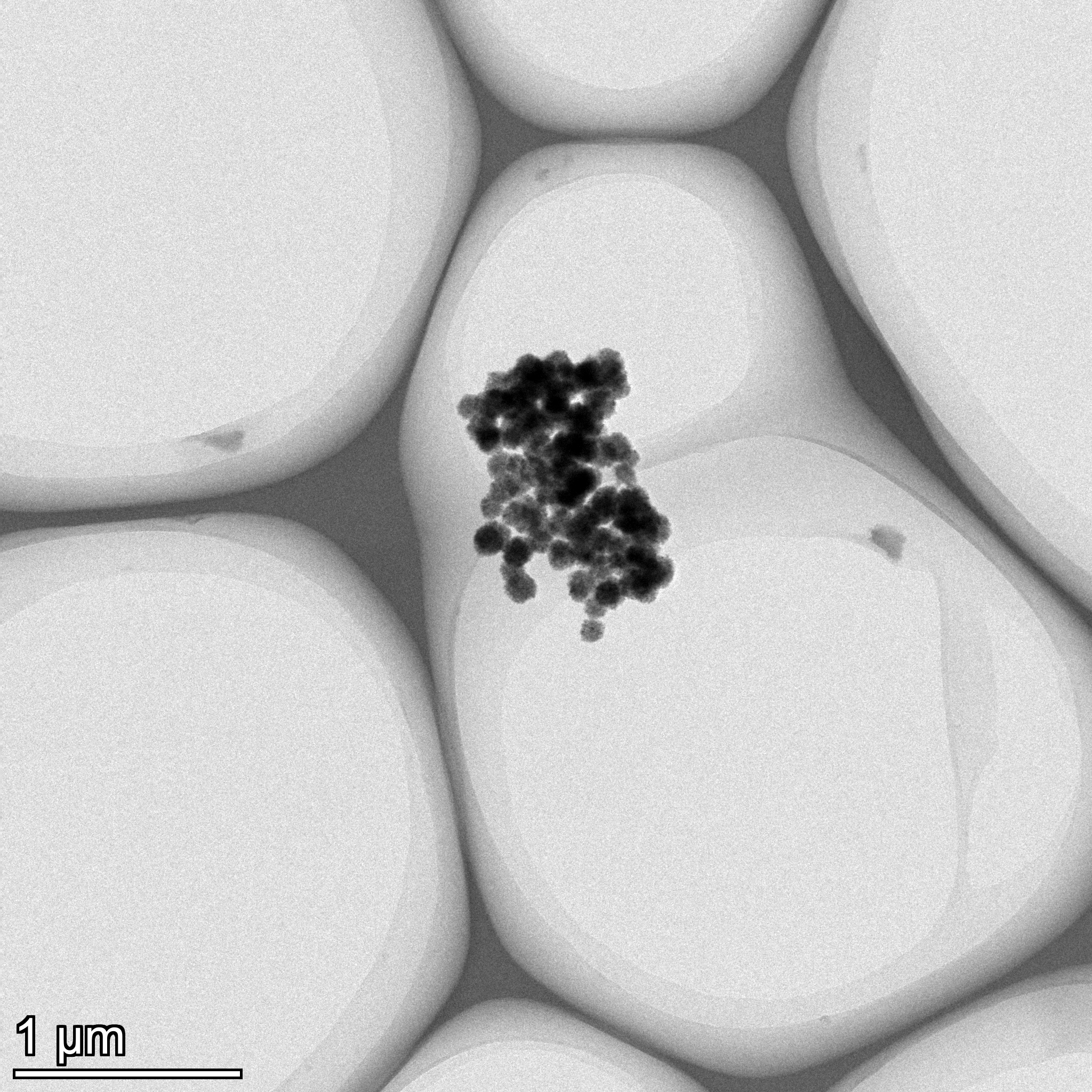 SplintR ligation-triggered in-situ rolling circle amplification on ...