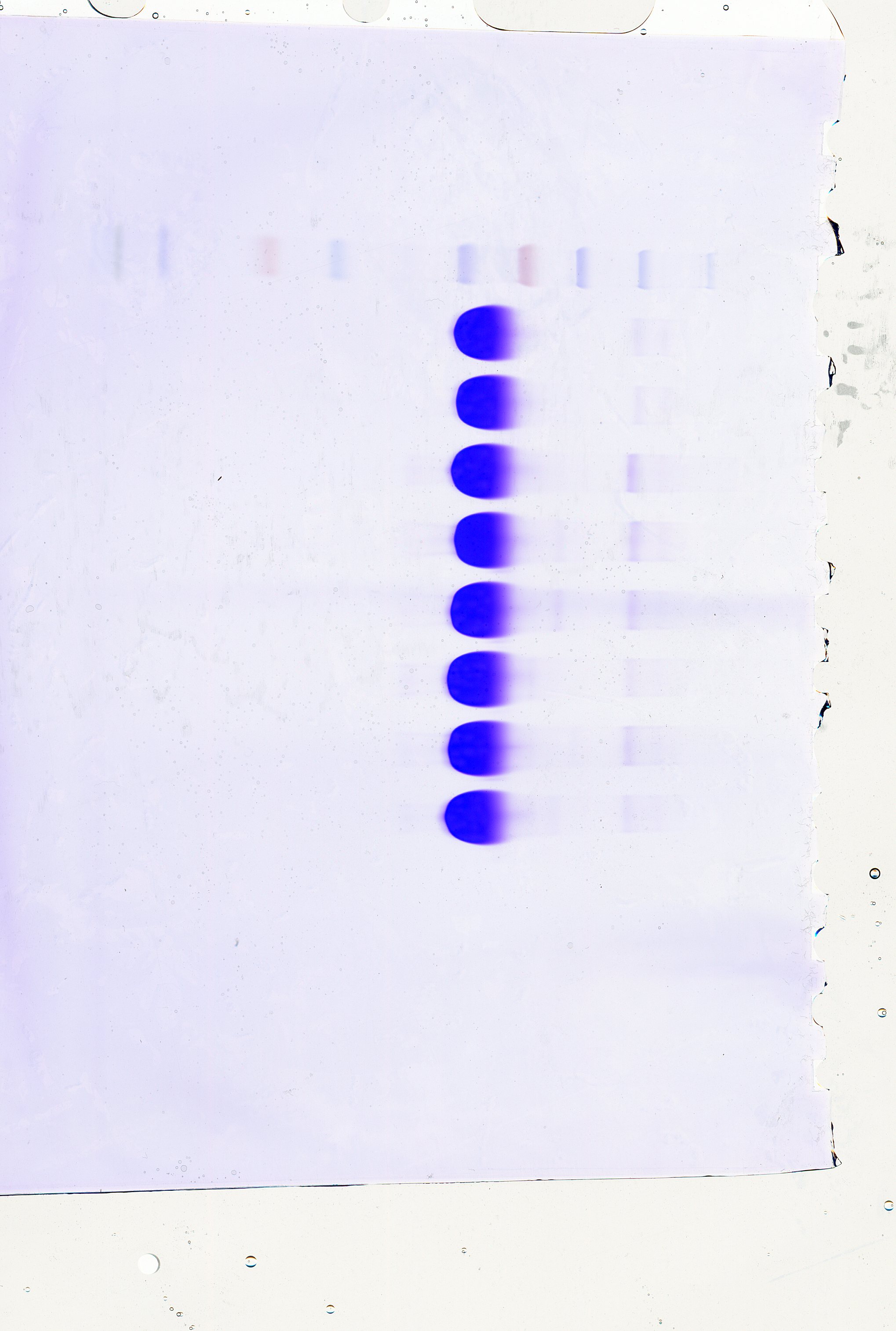 Protein composition analysis of human plasma-derived and recombinant ...