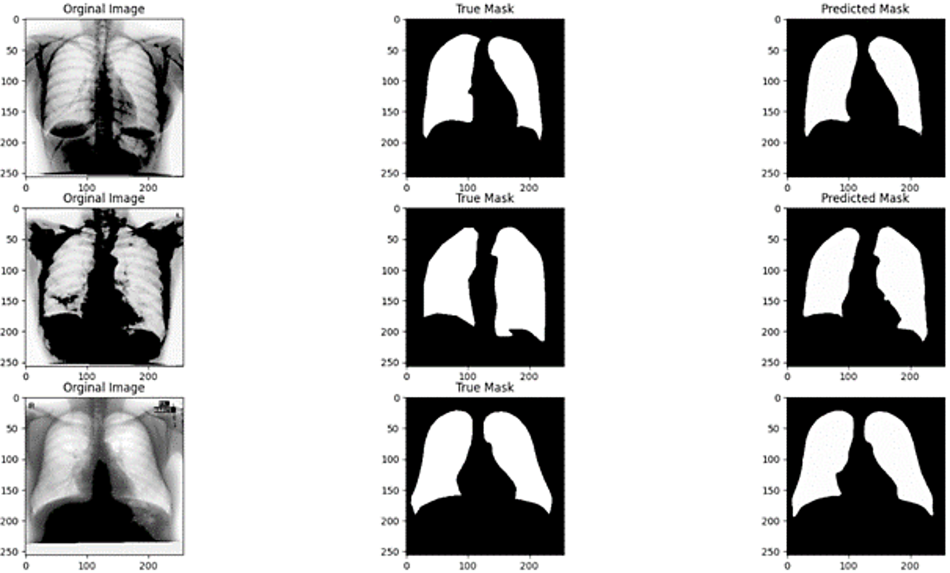 Lung image segmentation with improved U-Net, V-Net and Seg-Net techniques [PeerJ]