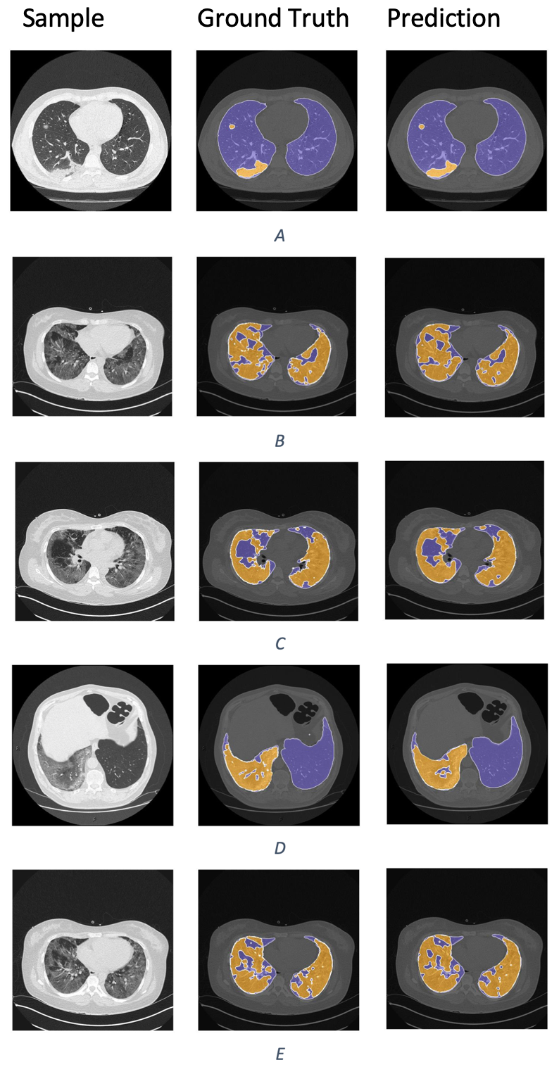 Decoders configurations based on Unet family and feature pyramid ...